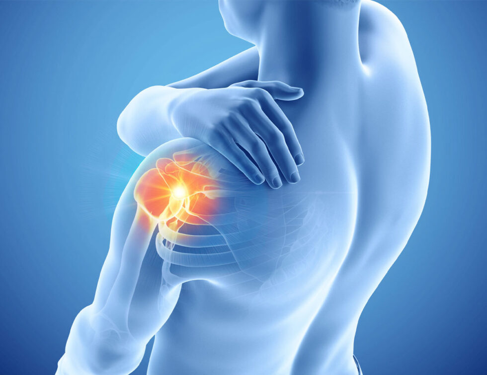 Pinched Nerve Treatment in Royersford, PA | Pain Relief Chiropractor